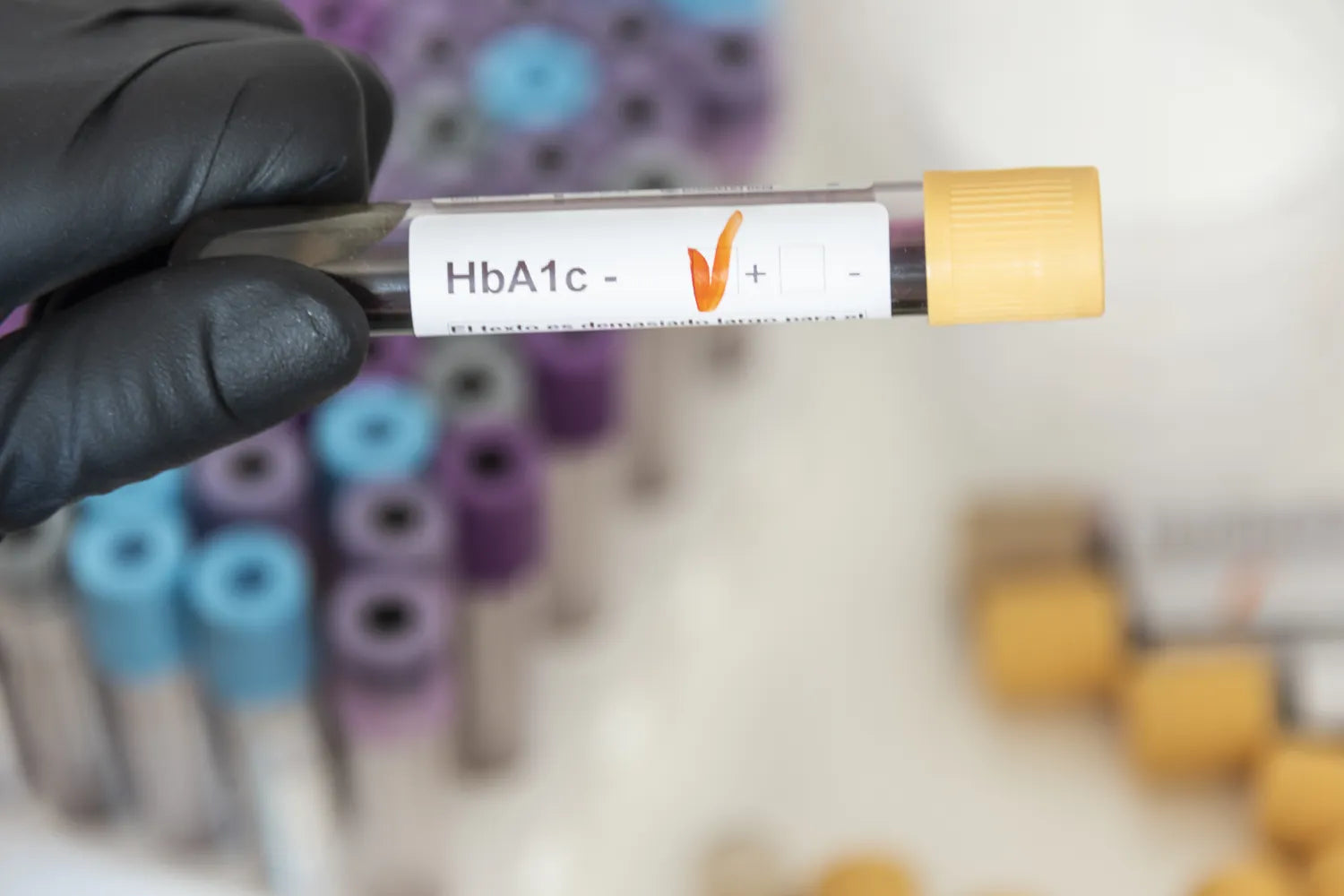 A1C by Age: What’s Considered Normal?